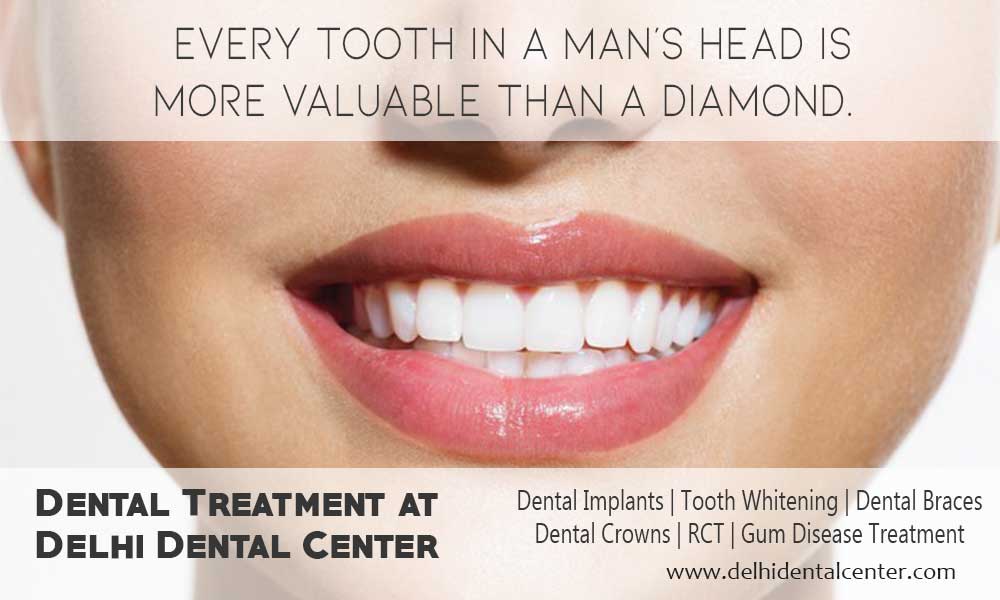 Zygomatic Dental Implant Treatment In Delhi, India