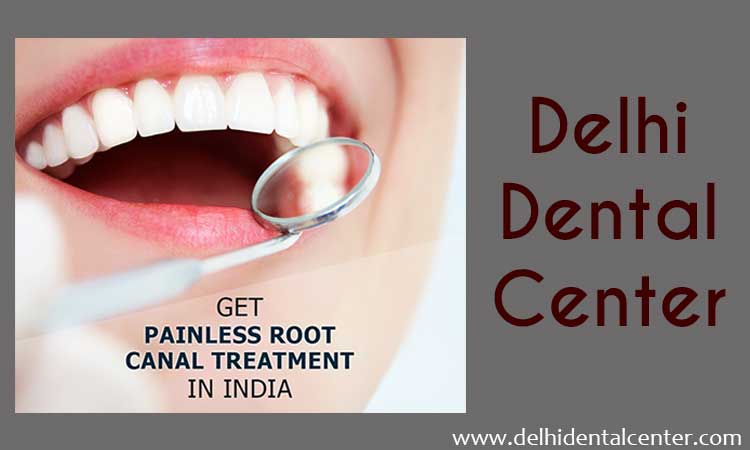 RCT Treatment in Shahdara Delhi – Delhi Dental Center
